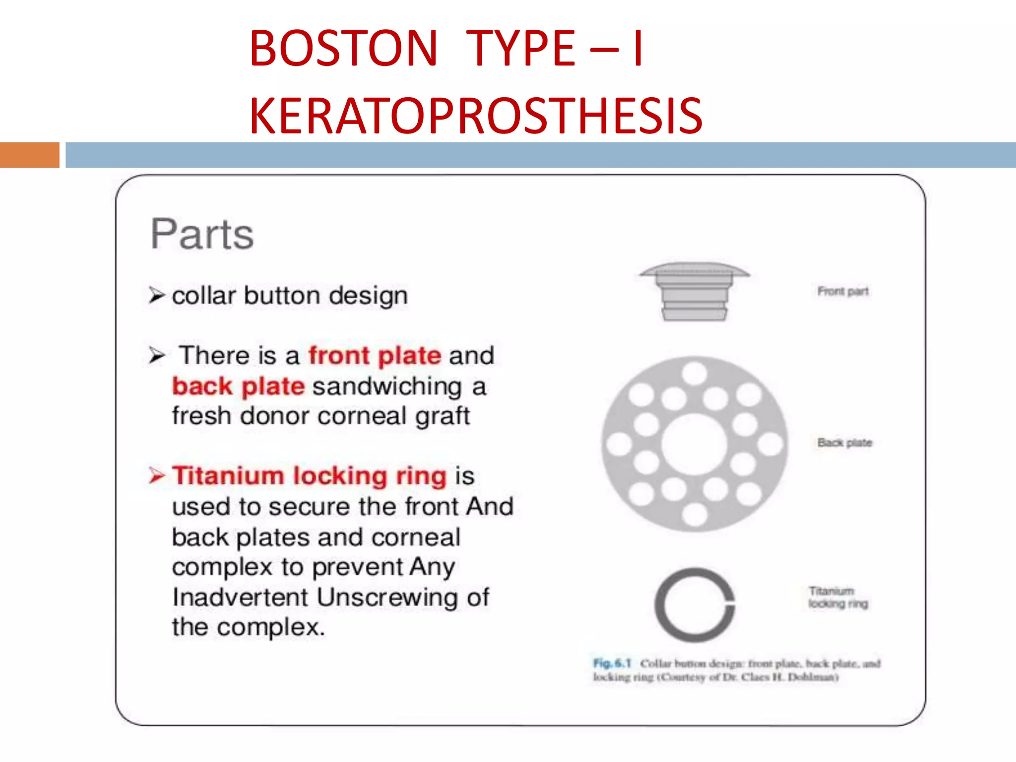 Keratoprothesis & osteoodonto keraoprosthesis | PPTX