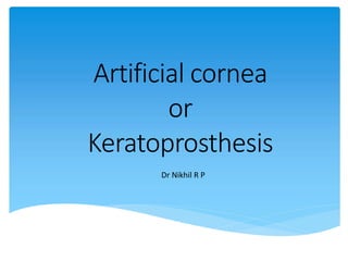 Keratoprsthesis | PPTX