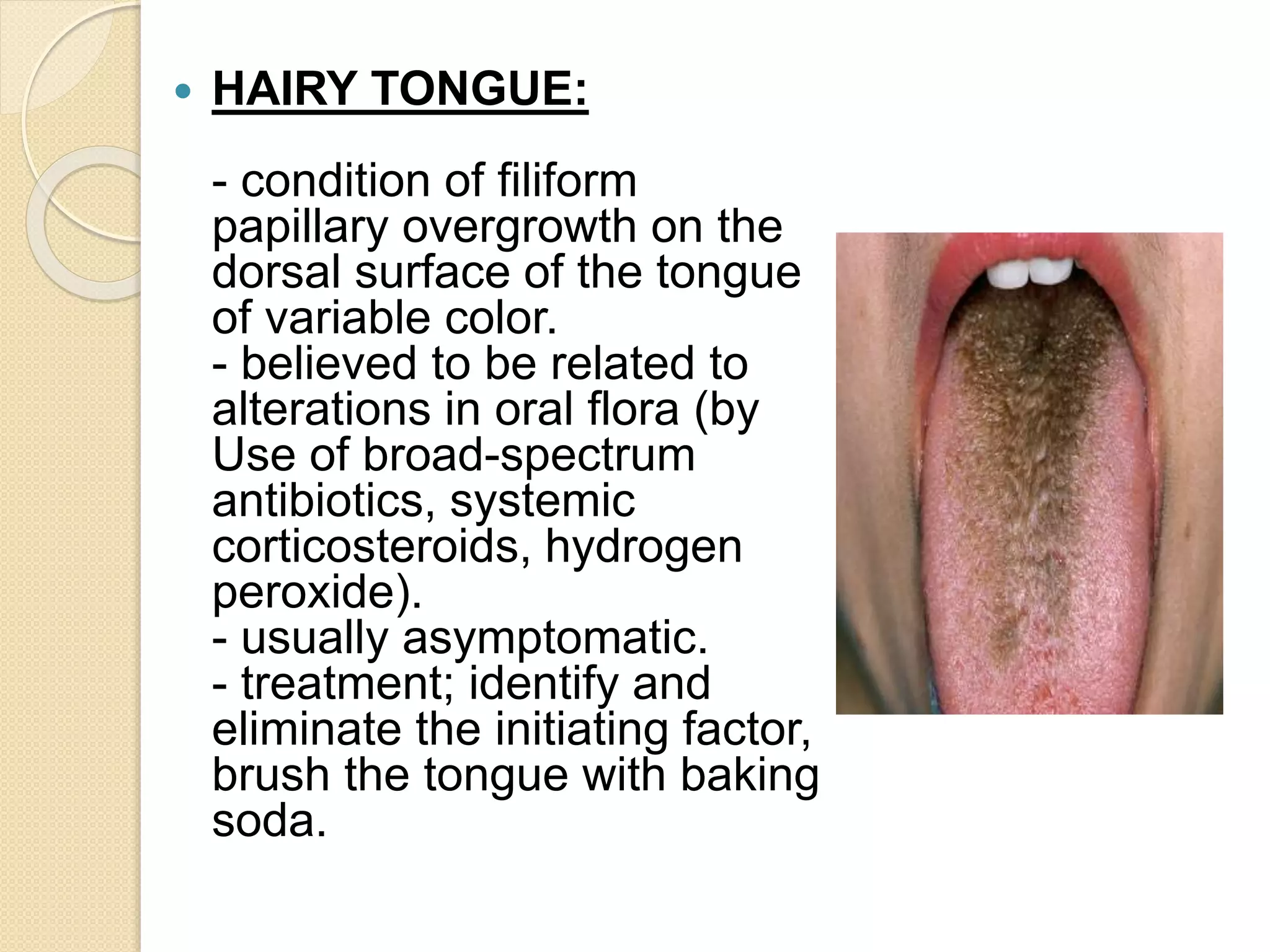Keratosis and-related-disorder-of-the-oral-mucosa | PPTX
