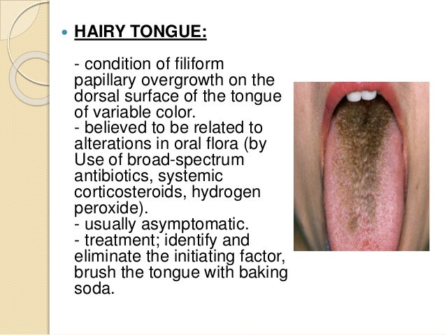 Oral Frictional Hyperkeratosis Tongue