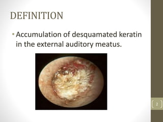 Keratosis obturans | PPTX