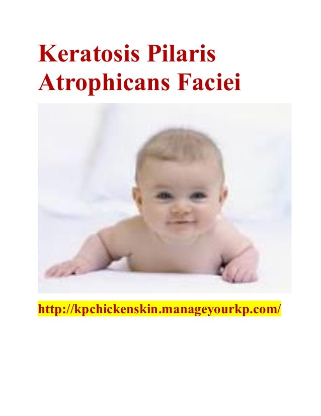 Keratosis Pilaris Atrophicans Faciei