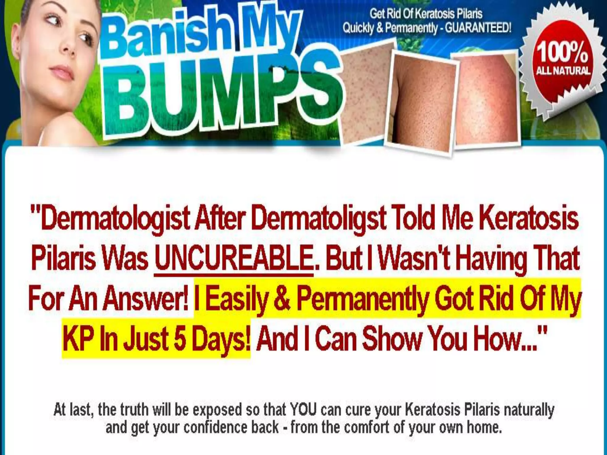 Keratosis Pilaris Cure Ppt