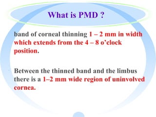 Keratotorus pellucid marginal degeneration | PPT
