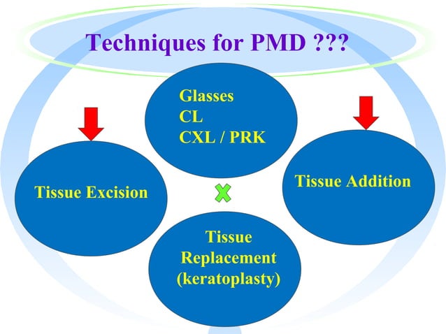 Keratotorus pellucid marginal degeneration | PPT | Eye and Vision ...