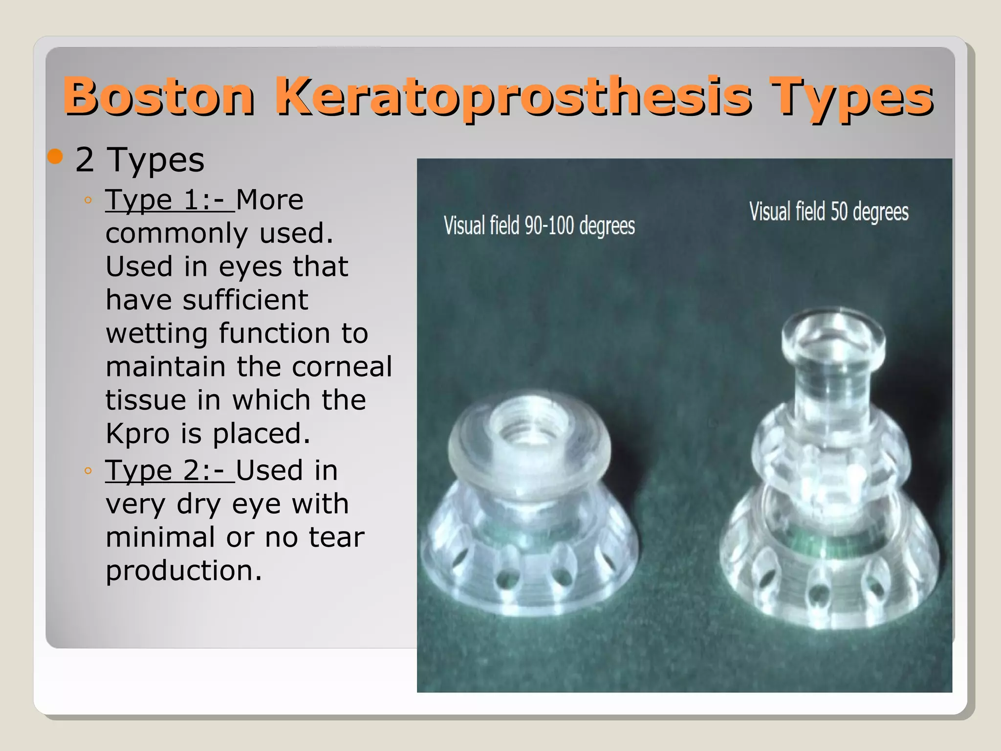 Keratprosthesis | PPT