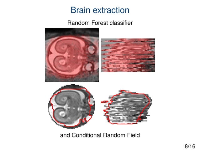 Automated Fetal Brain Segmentation From 2d Mri Slices For Motion Correction