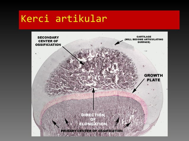 Kerci | PPT