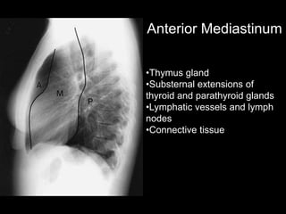 Kershaw select slides mediastinum masses | PPTX