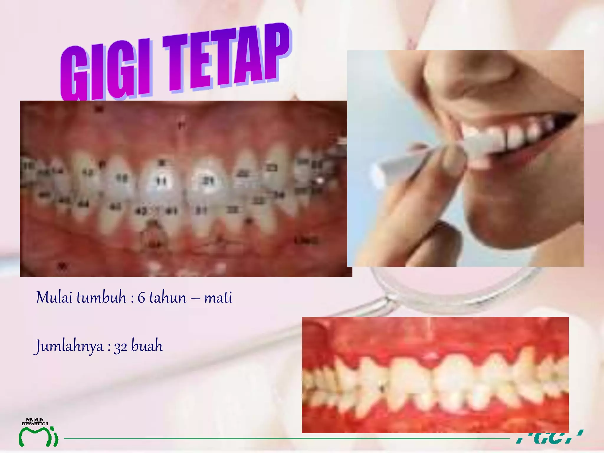 Kesehatan gigi anak prasekolah | PPT