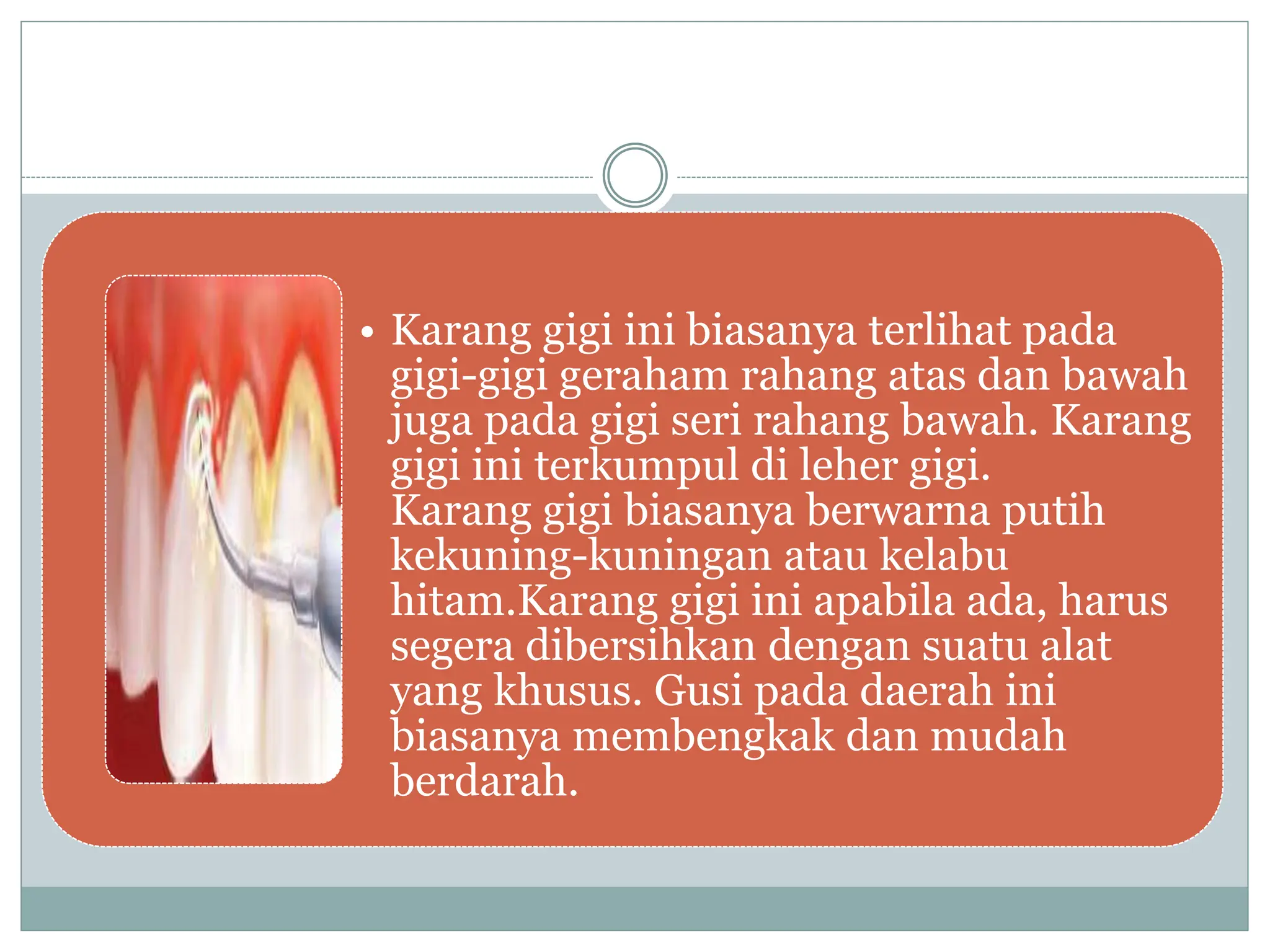 ppt kesehatan gigi dan mulut serta cara menyikat gigi dengan baik dan benar | PPT