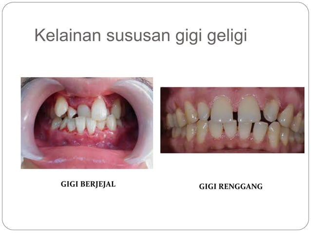 Kesehatan Gigi Dan Mulut drg. fuad.ppt