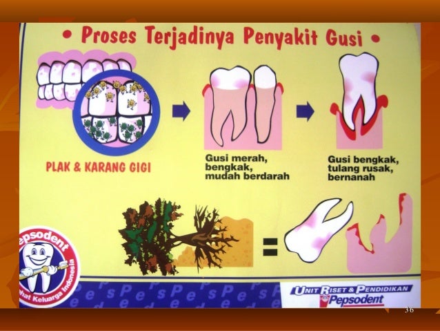 Kesehatan Gigi dan Mulut