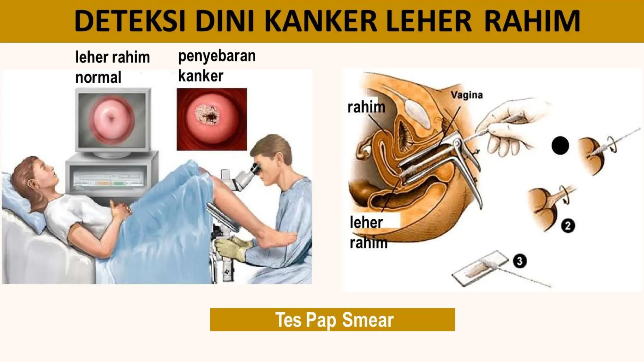 Kesehatan Reproduksi bagi Calon Pengantin, DT.pptx
