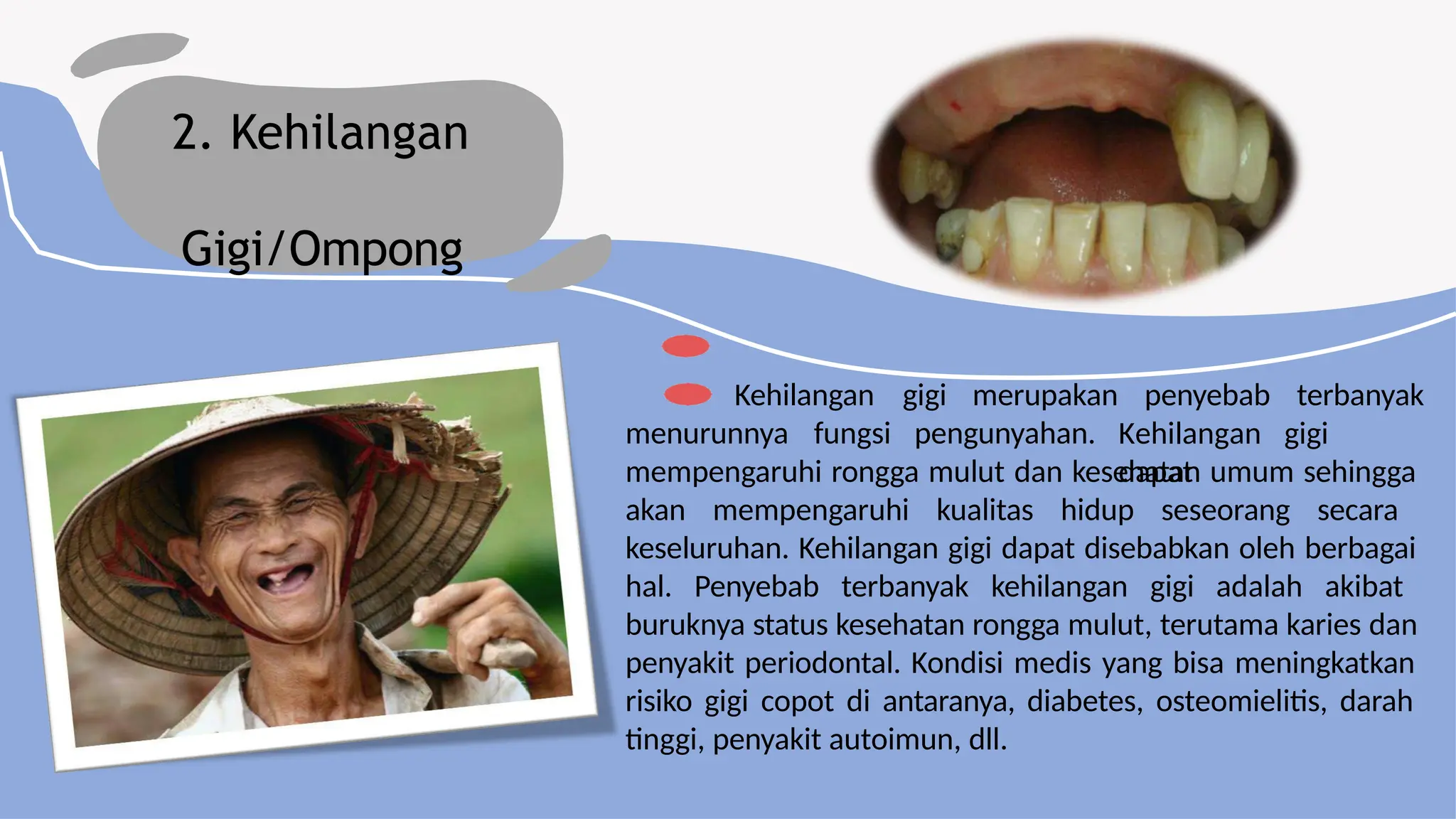 Kesehatan gigi dan mulut pada lansia sehari hari | PPTX