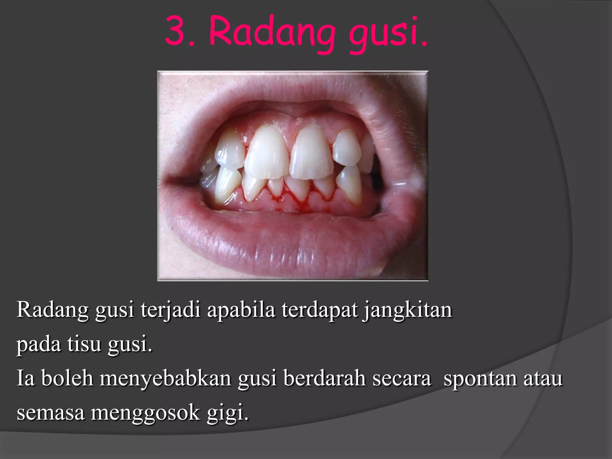 KESIHATAN MULUT DAN GIGI KANAK-KANAK & PELAJAR SEKOLAH RENDAH | PDF