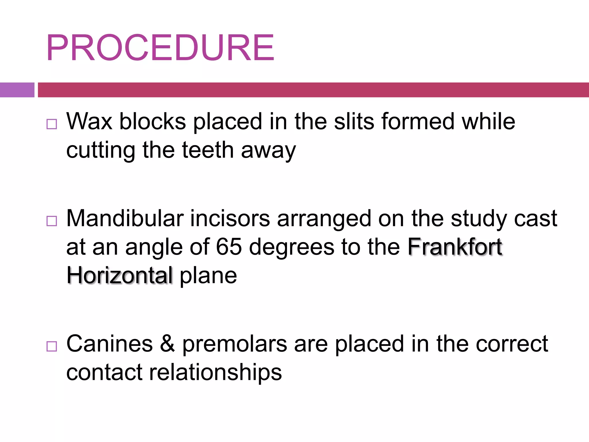 Kesling dagnostic setup | PPTX