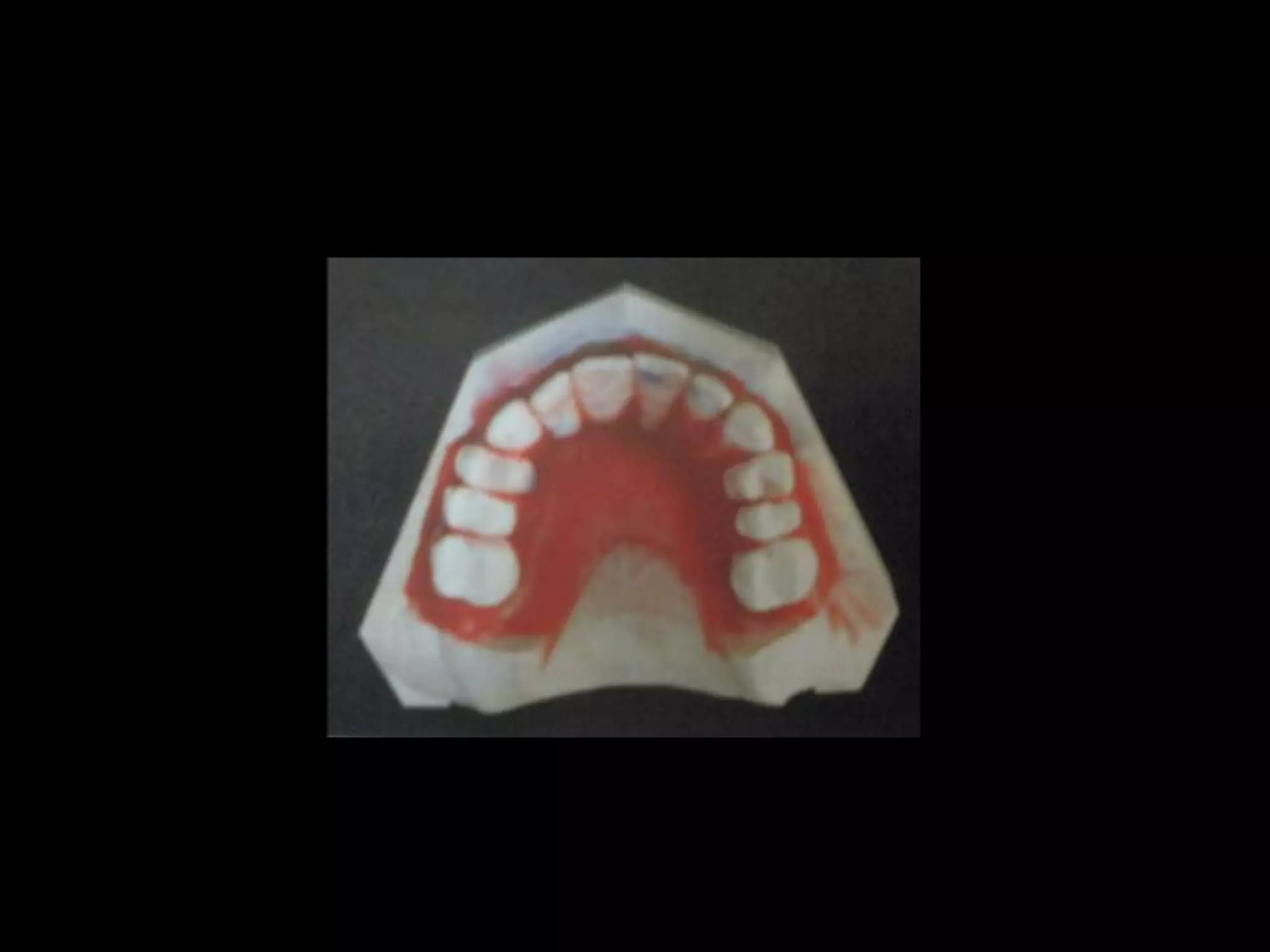 Kesling dagnostic setup | PPTX