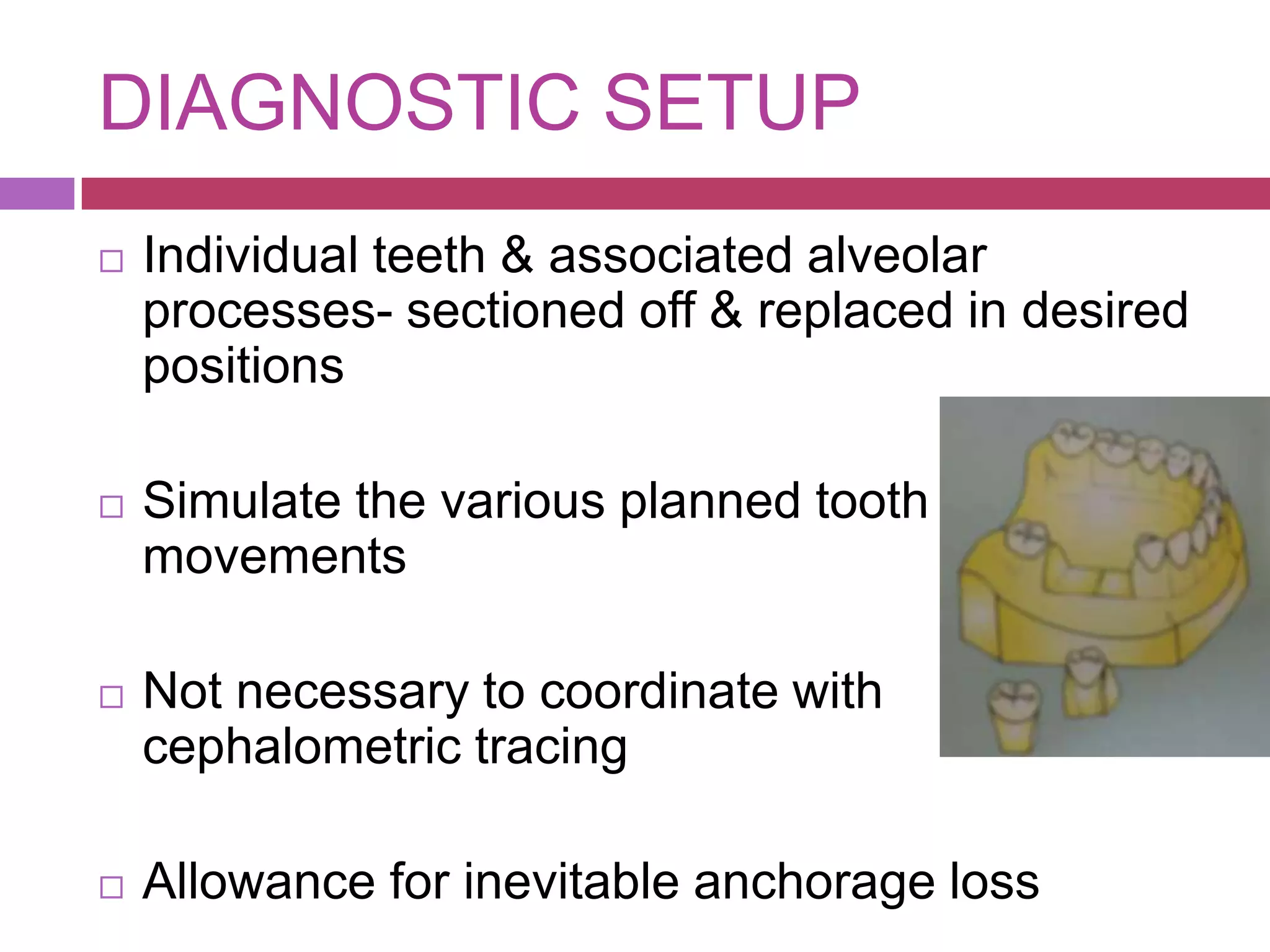 Kesling dagnostic setup | PPTX