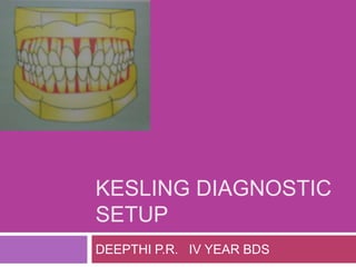 Kesling dagnostic setup | PPTX