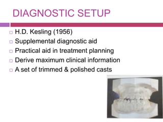 Kesling dagnostic setup | PPTX
