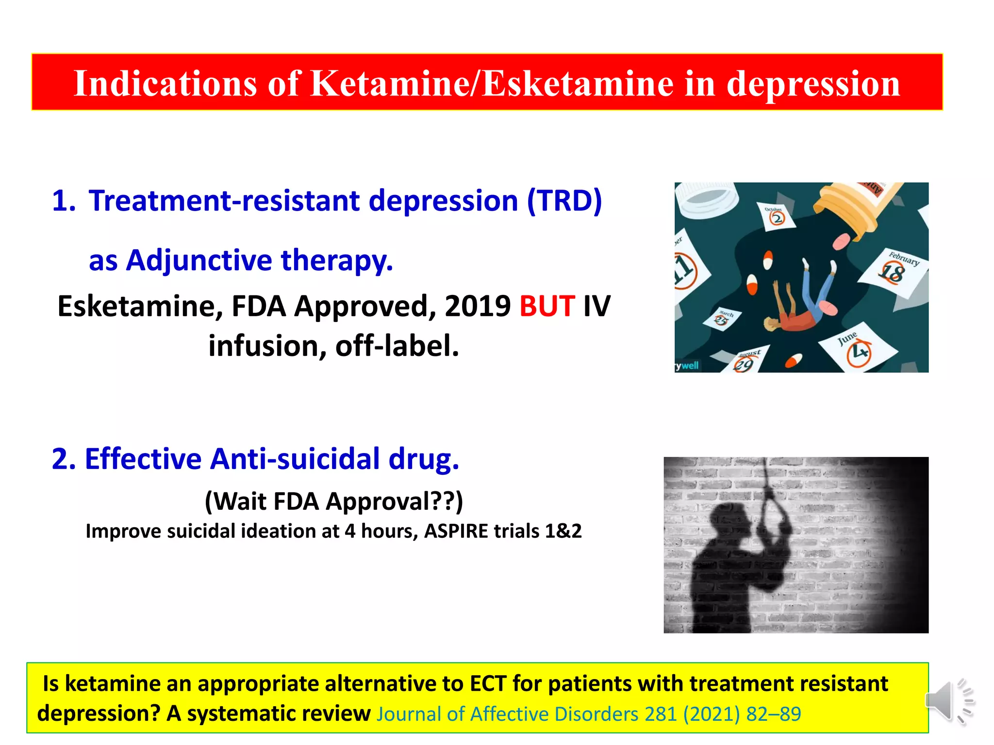 Ketamine and Intranasal Esketamine in Depression | PDF