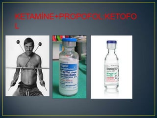 Ketofol mehmet tatli | PPTX