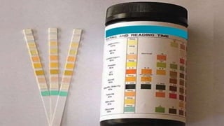 Ketone Bodies Estimation in Urine.biochemistry.pptx