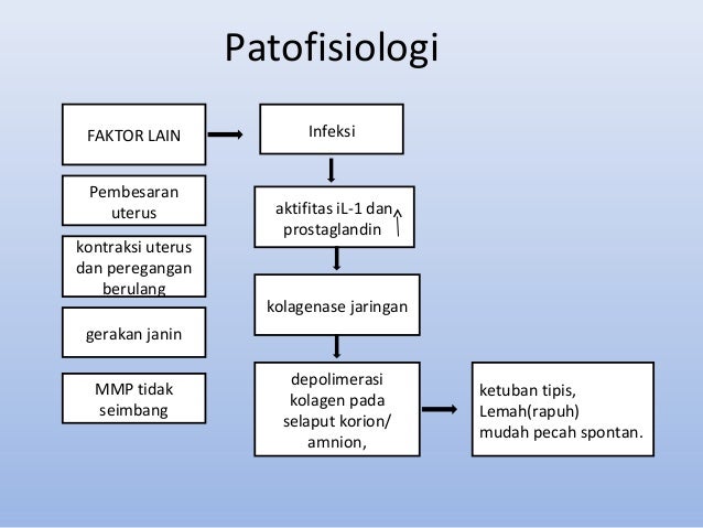 Ketuban pecah dini ppt