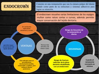 Endocrown_caso clinico | PPT