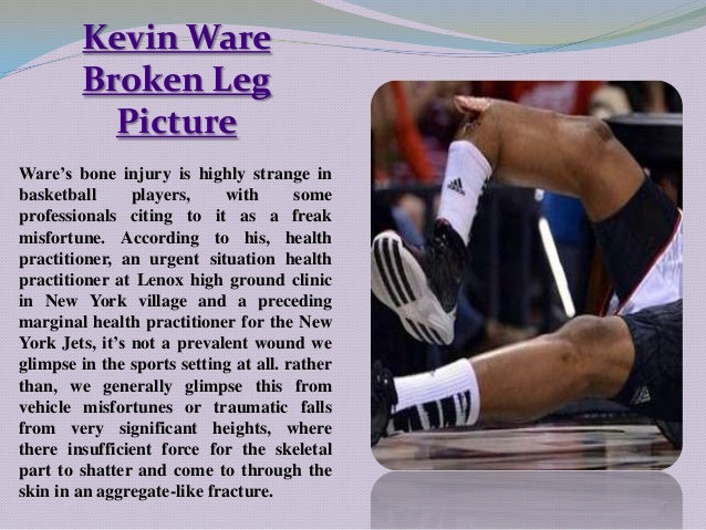 Louisville Basketball Kevin Ware Leg Injury Video | semashow.com