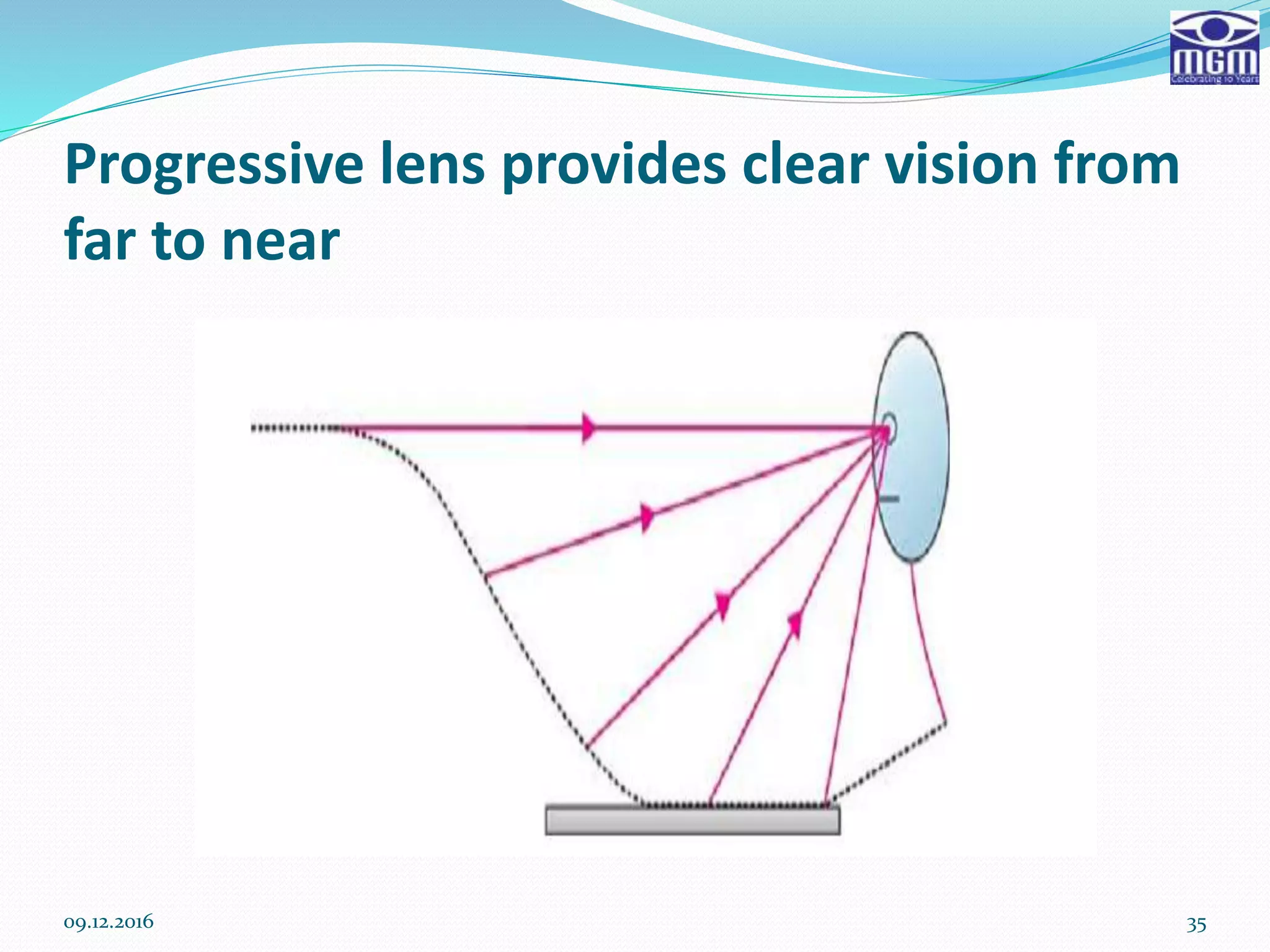 Progressive Adition Lens | PPTX