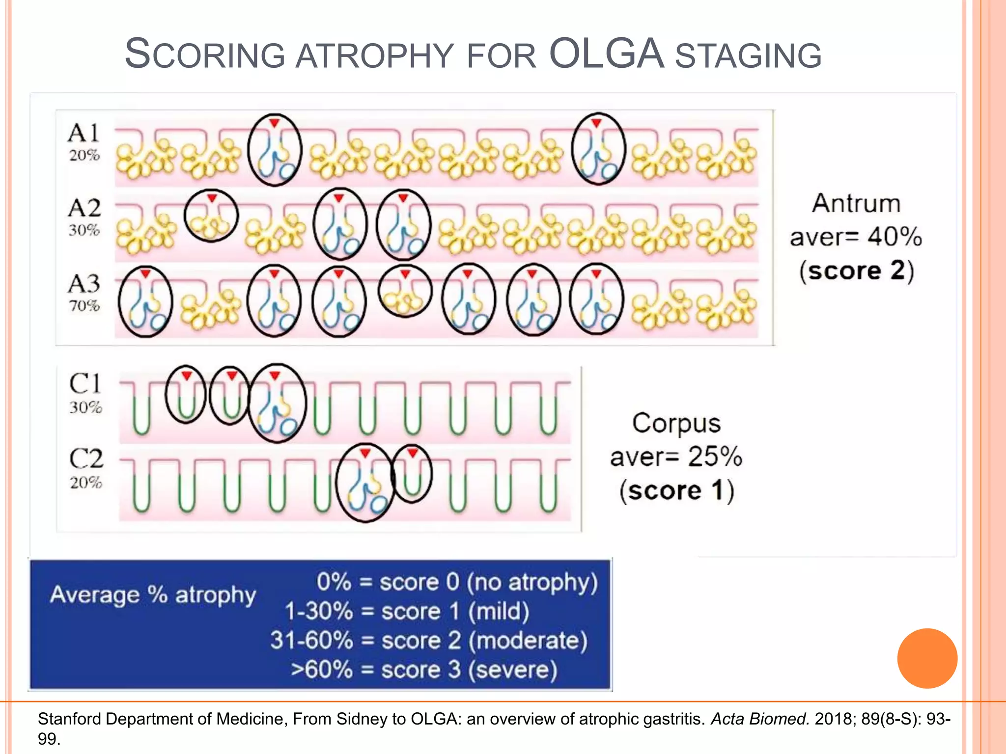 The role of non-invasive diagnosis in the evolution of chronic atrophic ...