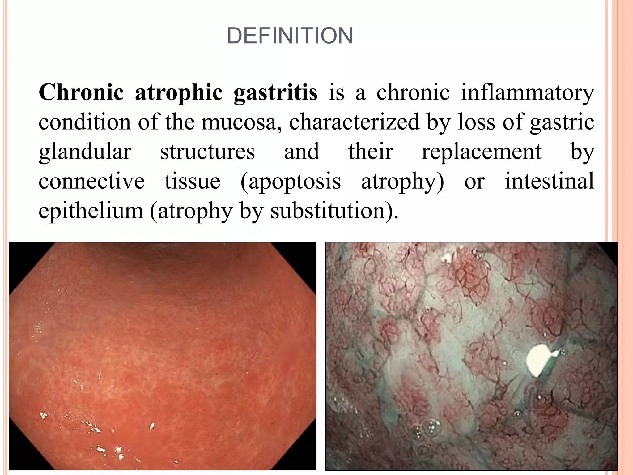 The role of non-invasive diagnosis in the evolution of chronic atrophic ...