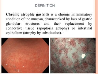 The role of non-invasive diagnosis in the evolution of chronic atrophic ...