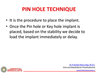Key hole dental implants INDIA | PDF