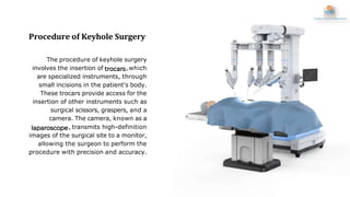 Keyhole Surgery.pptx