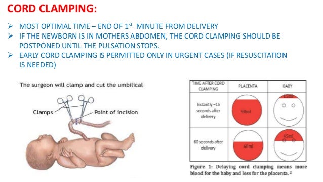 Key principles of newborn care at birth