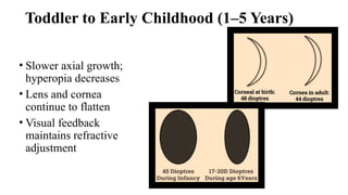 Emmetropization: Key Developmental Stages | PPTX