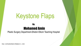 Keystone flaps | PPTX | Skin and Dermatology | Diseases and Conditions