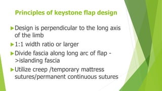 Keystone flaps | PPT