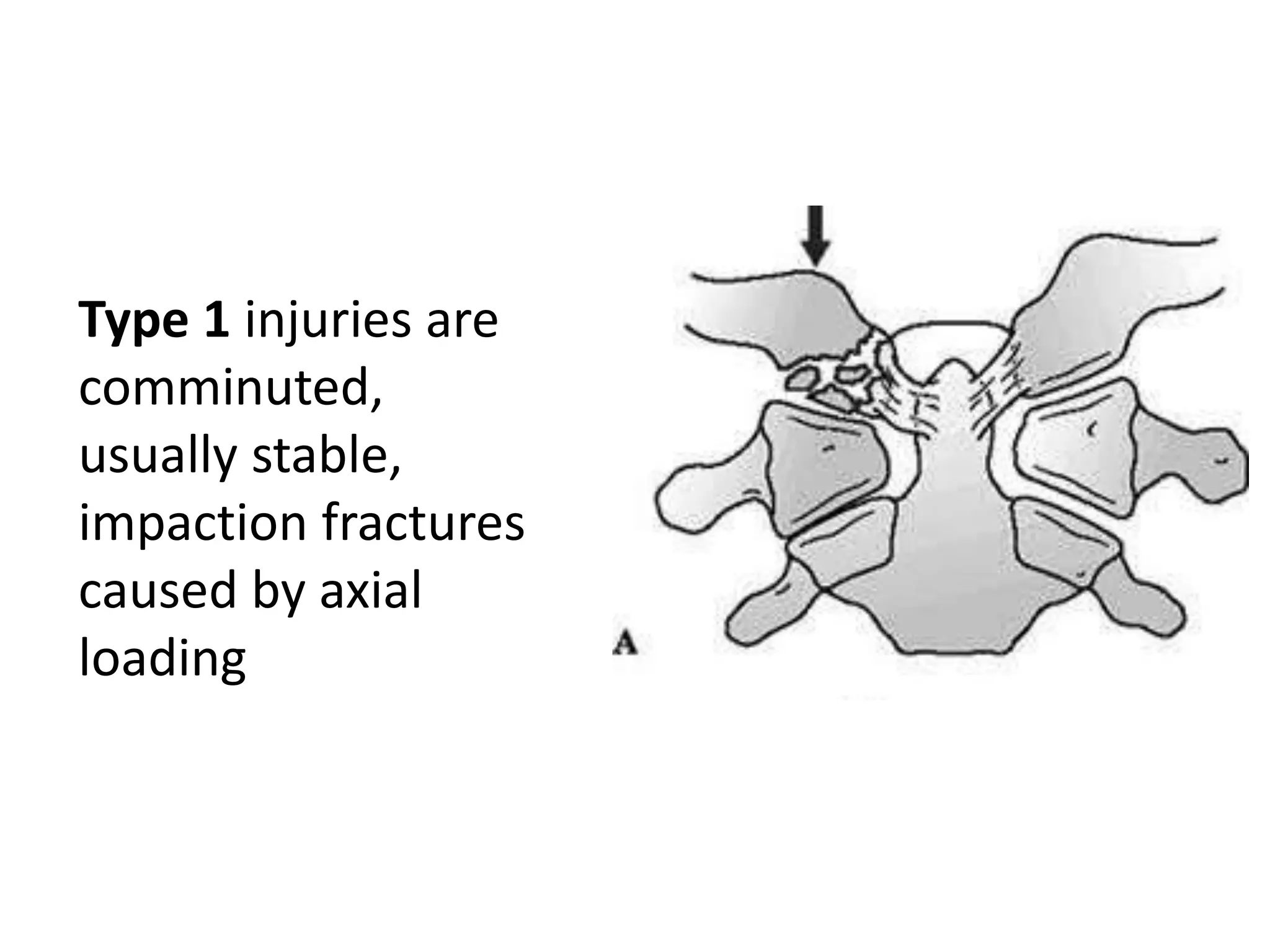 Cervical Spine Fractures and injuries classification | PPT