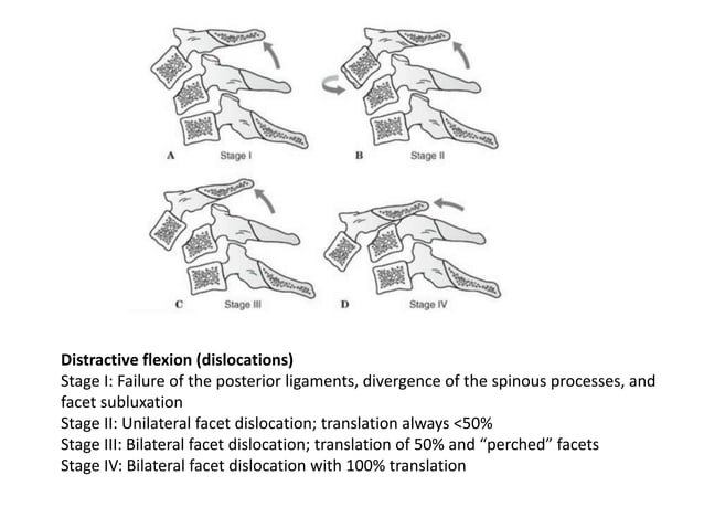 Cervical Spine Fractures and injuries classification | PPTX | Death ...