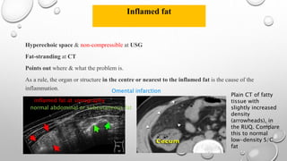 Acute abdomen surgeons perspective | PPTX