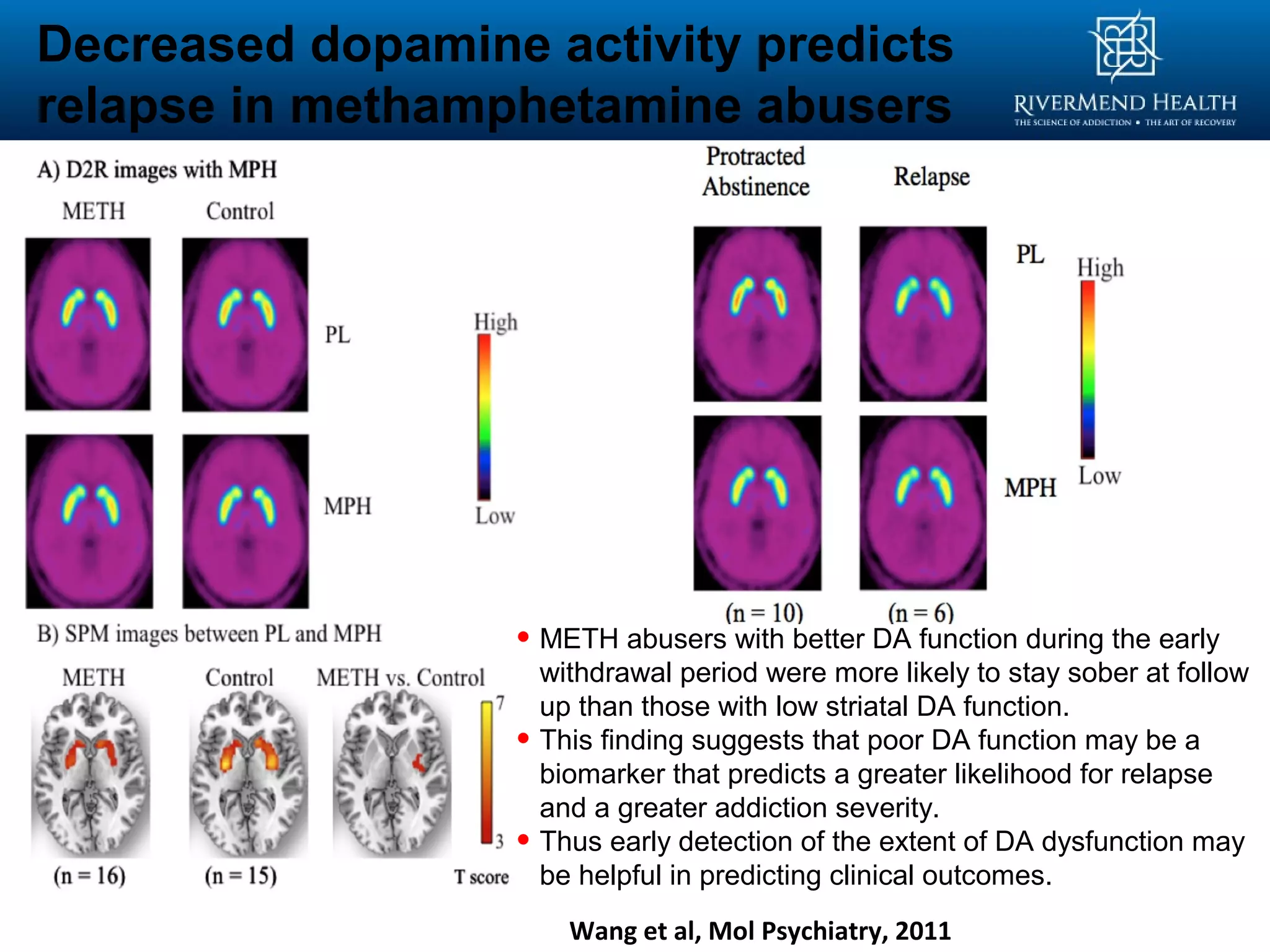Addiction as a brain disease Brain Imaging in Addictions | PPT