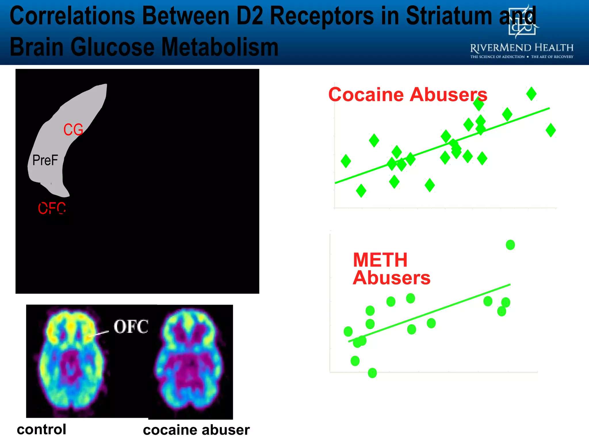 Addiction as a brain disease Brain Imaging in Addictions | PPT