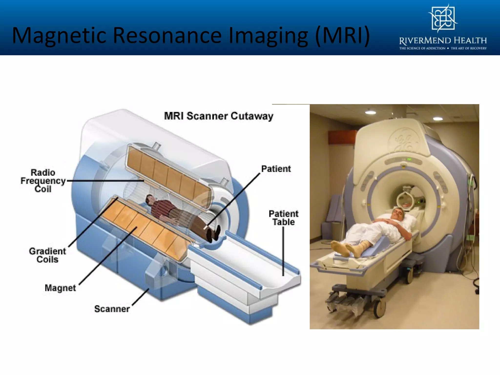 Addiction as a brain disease Brain Imaging in Addictions | PPT