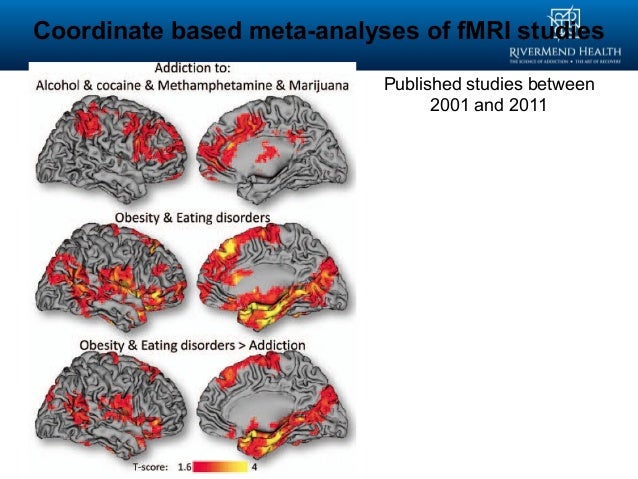 Addiction as a brain disease Brain Imaging in Addictions