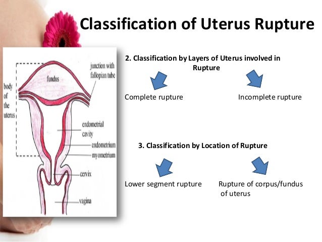 BIRTH CANAL TRAUMA AND UTERUS RUPTURE