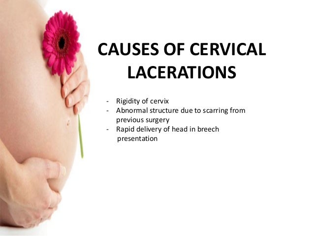 Labia Laceration During Childbirth – LTAX